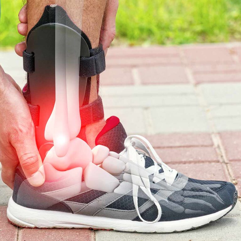 Ankle Instability | Alexandria, Fairfax, Arlington, VA