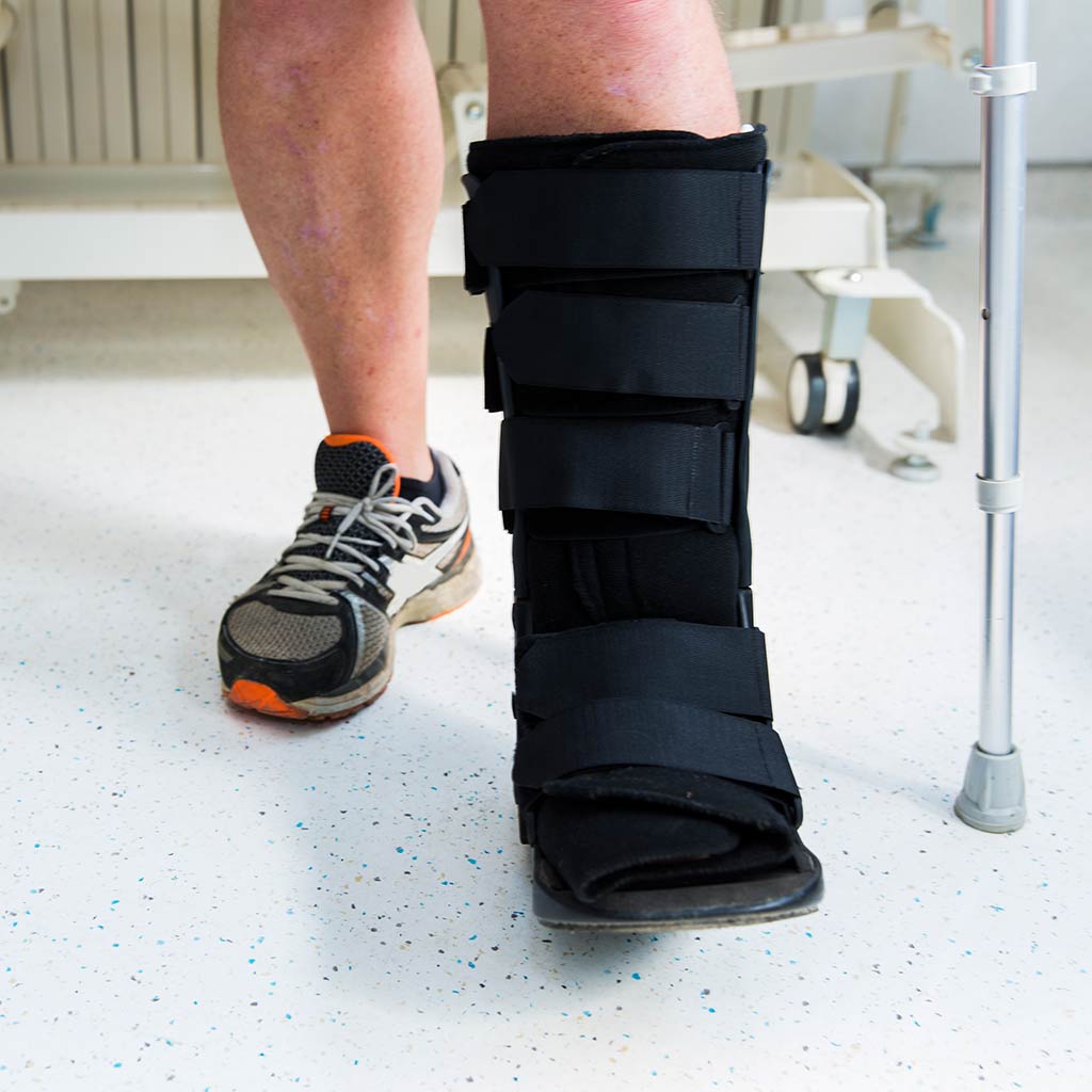 Foot & Ankle Surgery | Chevy Chase, Potomac, Rockville, MD